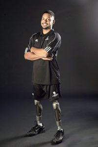 Prosthetics – Prosthetics & Orthotics Company USA
