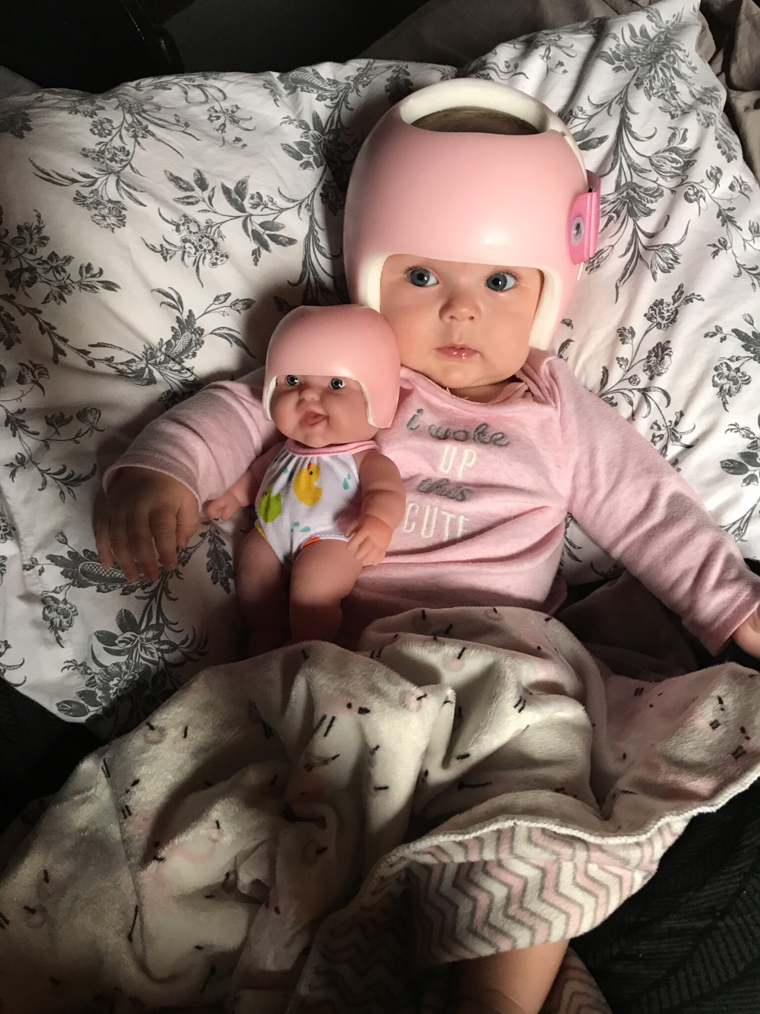 Cranial Helmets – Prosthetics & Orthotics Company USA